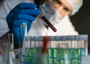 Why Graduates of a Medical Lab Technician Program Are So Important to ...